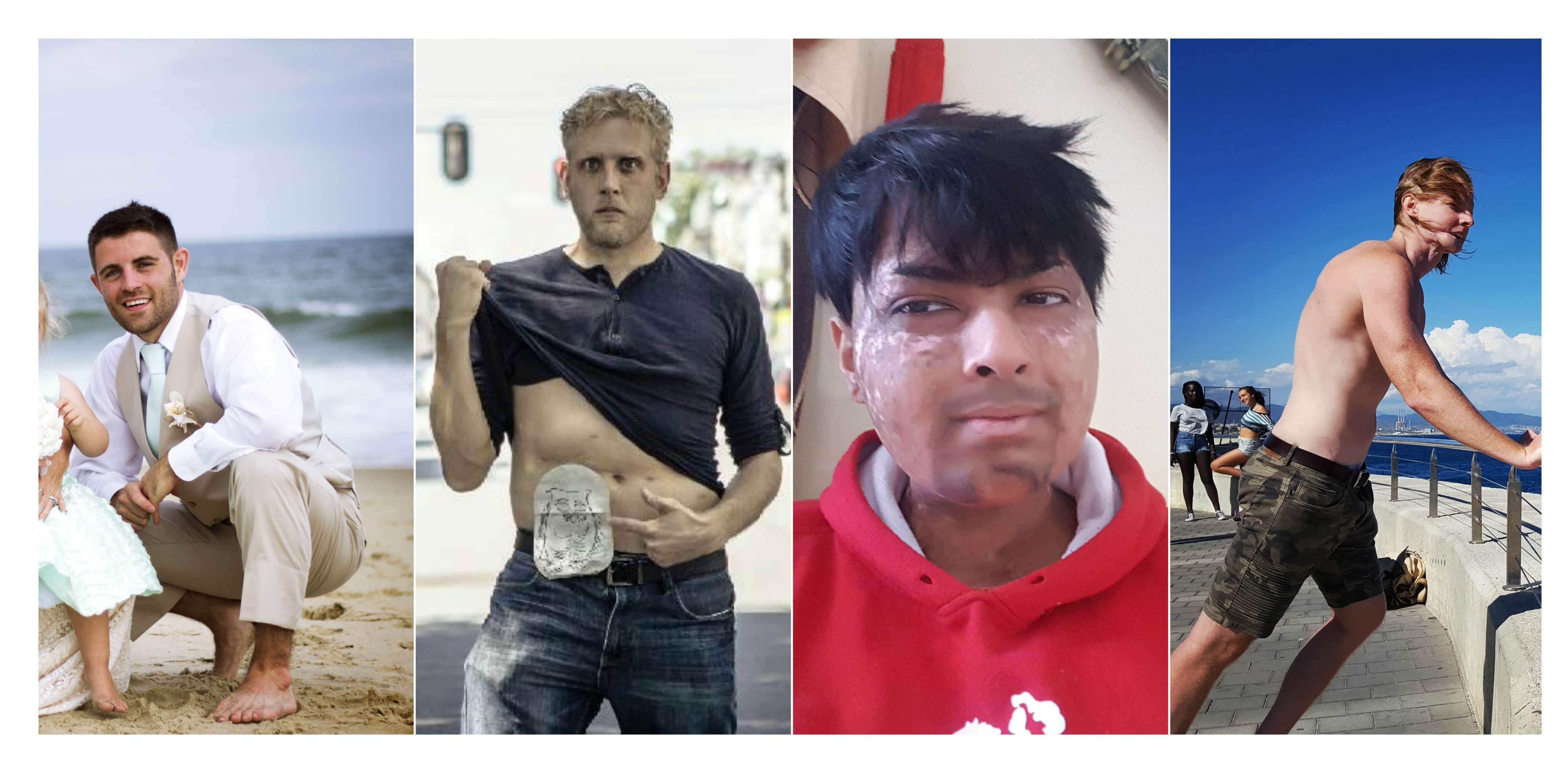 10 Men Who Embody The Meaning Of Strength | IHadCancer