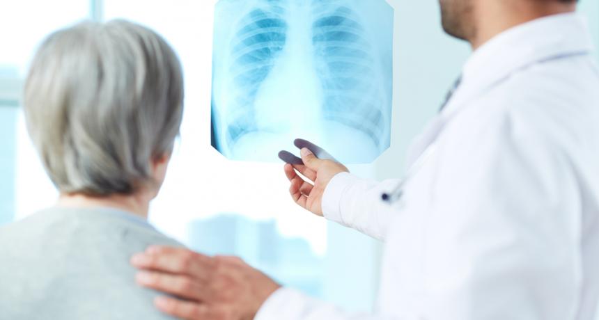 Will My "Scanxiety" Ever Go Away?