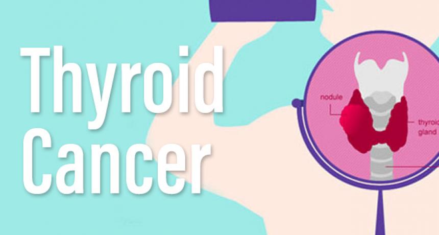 Thyroid Cancer A Visual Guide